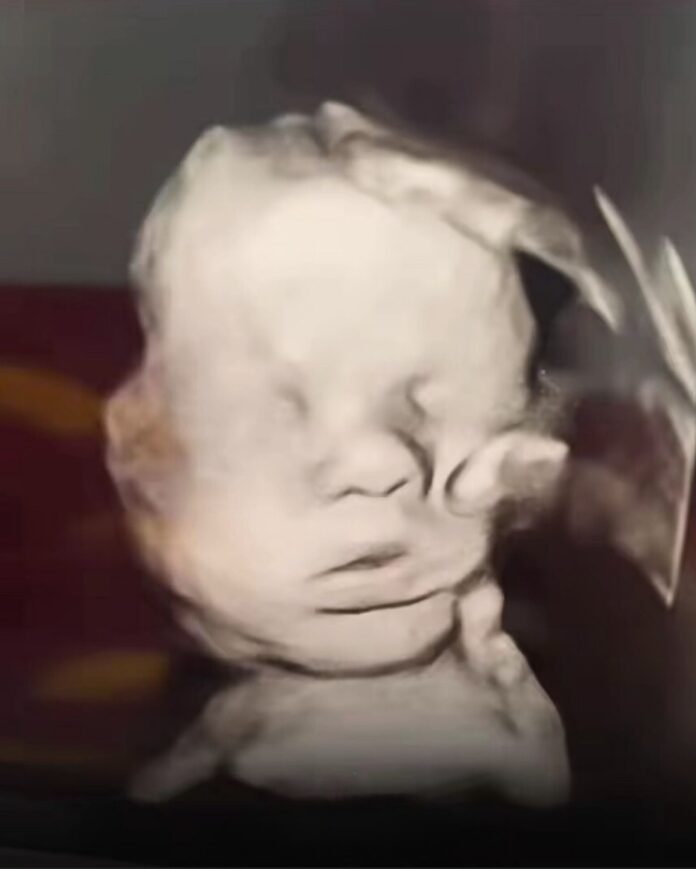 Nevjerojatan prizor s ultrazvuka obišao svijet: 'To je Božja ruka'