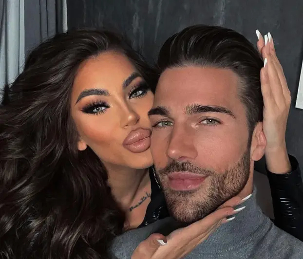 FOTO Hana Rodić operirala nos, pogledajte kako izgleda nakon operacije